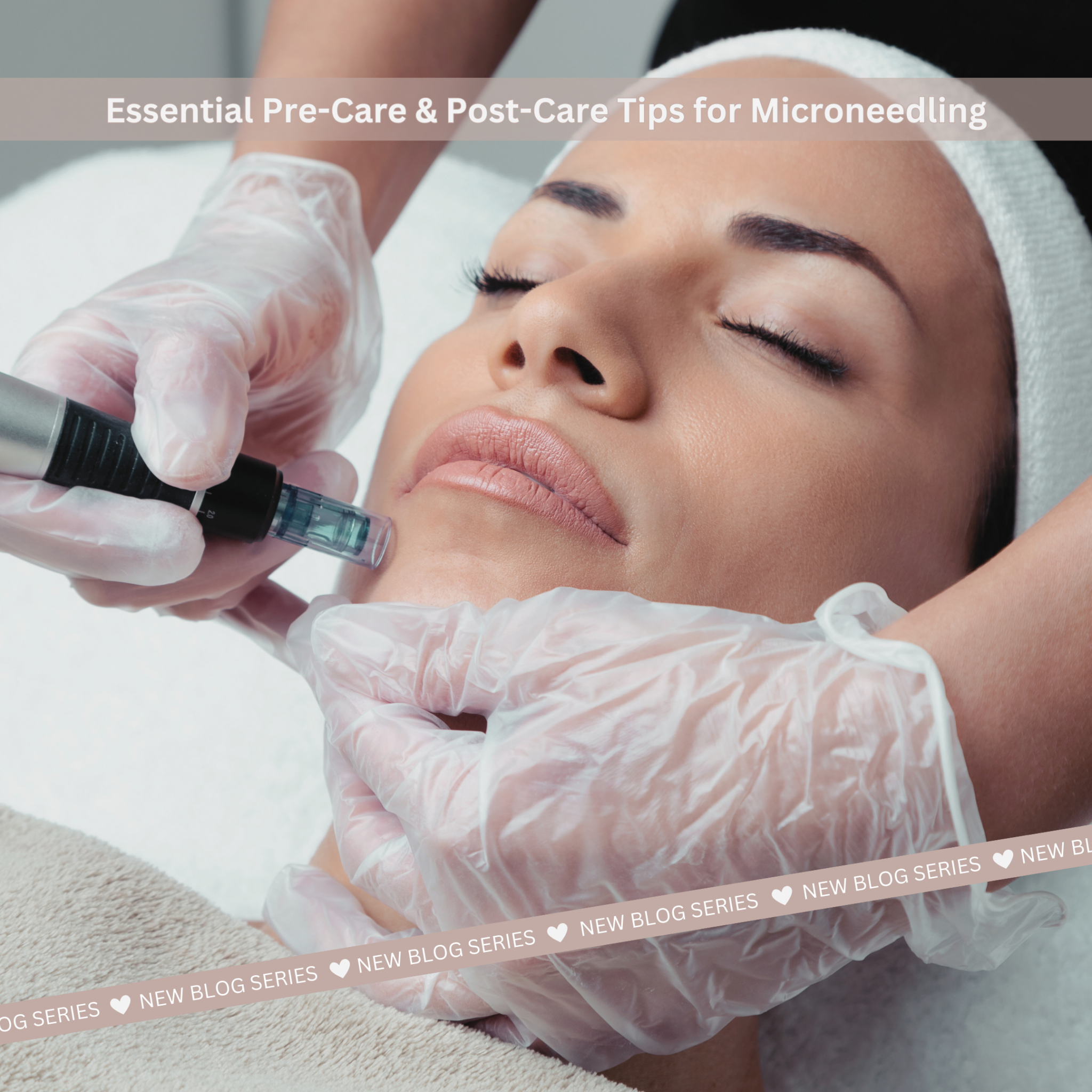 Vivace RF & SkinPen Microneedling: Pre/Post-Care Essentials